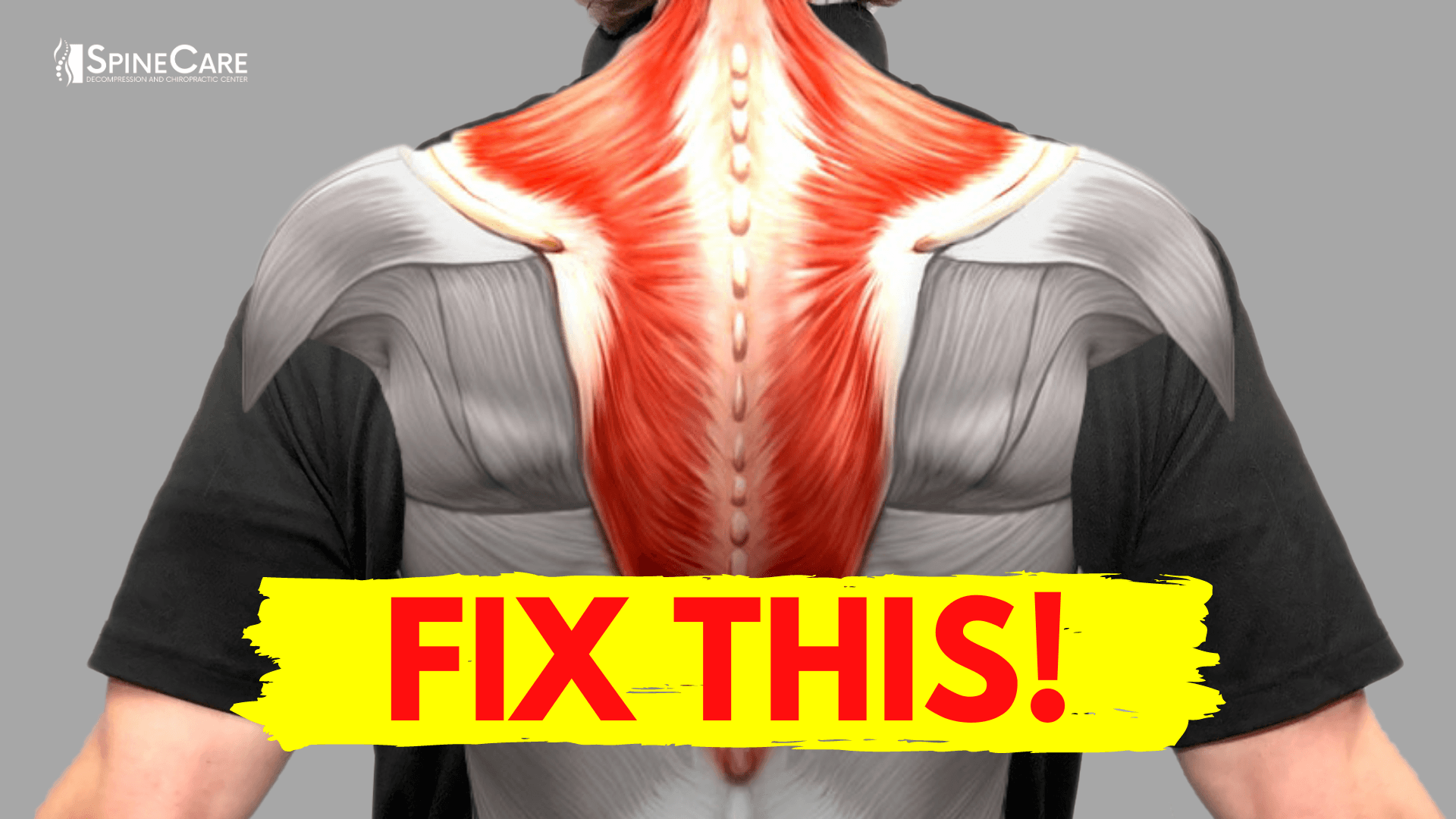 How To Fix Muscle Knots In Your Neck Shoulder In 30 SECONDS SpineCare